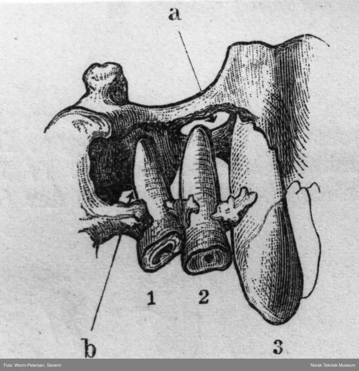 Illustrasjon, snitt av tenner i overkjeve - Norsk Teknisk Museum ...